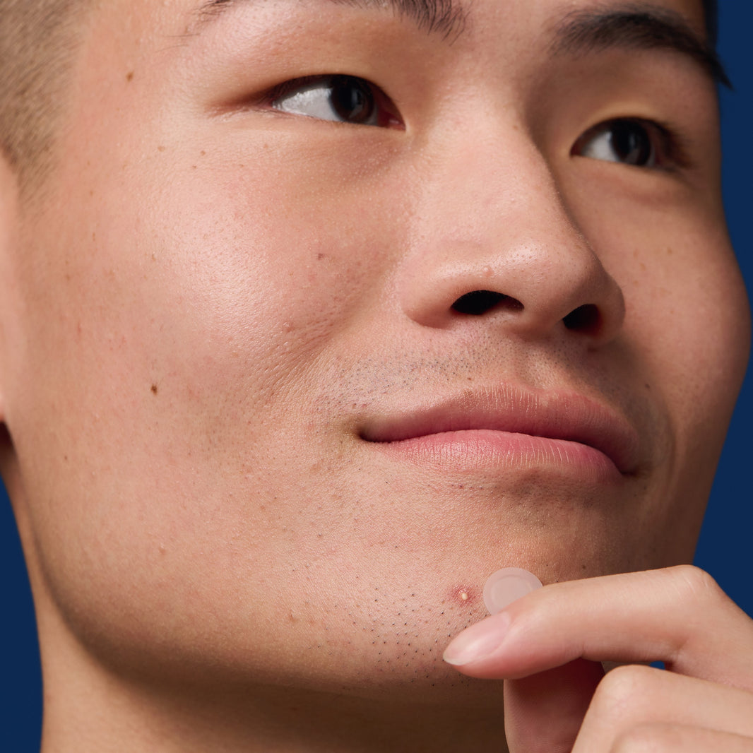 Pflaster gegen Pickel, Flecken und Unreinheiten | Hero Cosmetics